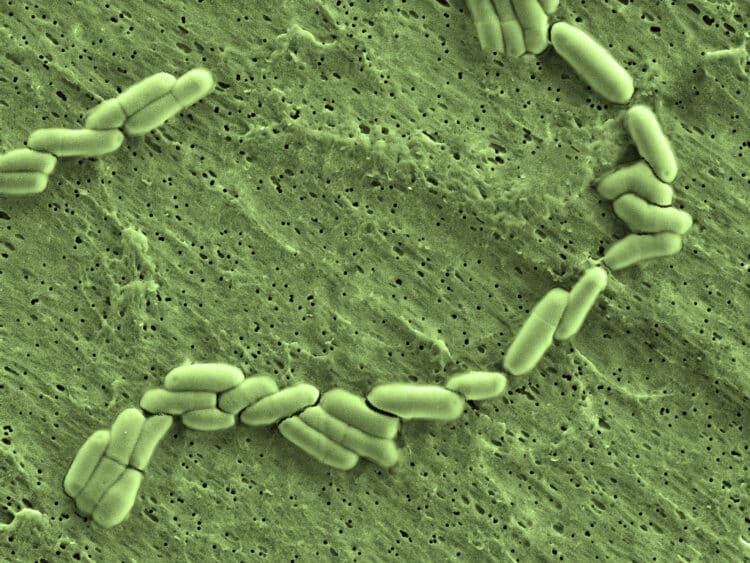 Молочнокислые бактерии смягчили последствия инфаркта